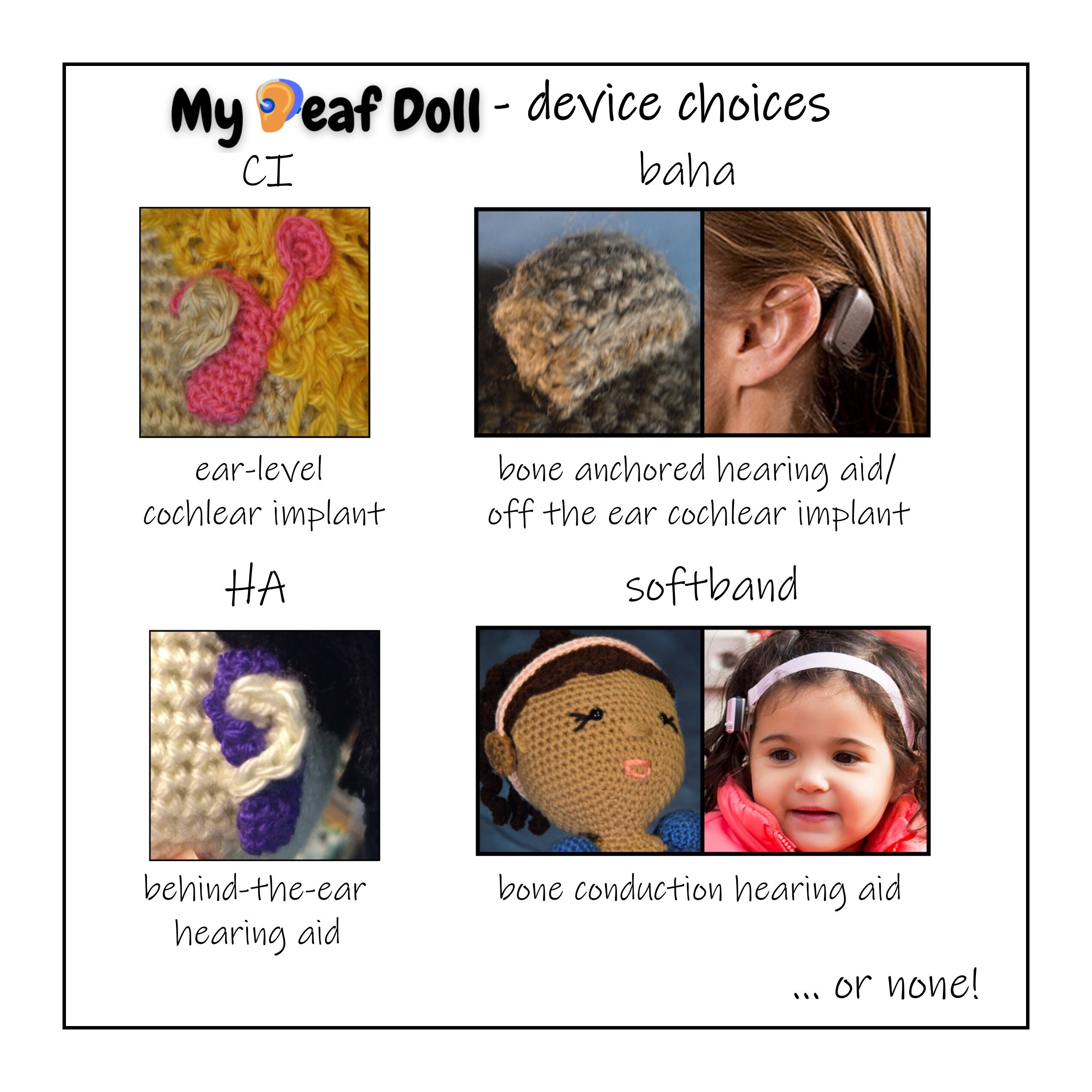 Deaf Doll With Hearing Aids/cochlear Implants - Designed by You! - Etsy