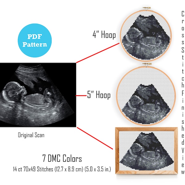Ultrasound Sonogram - Etsy