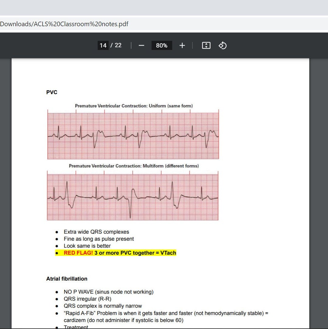 ACLS Notes - Etsy