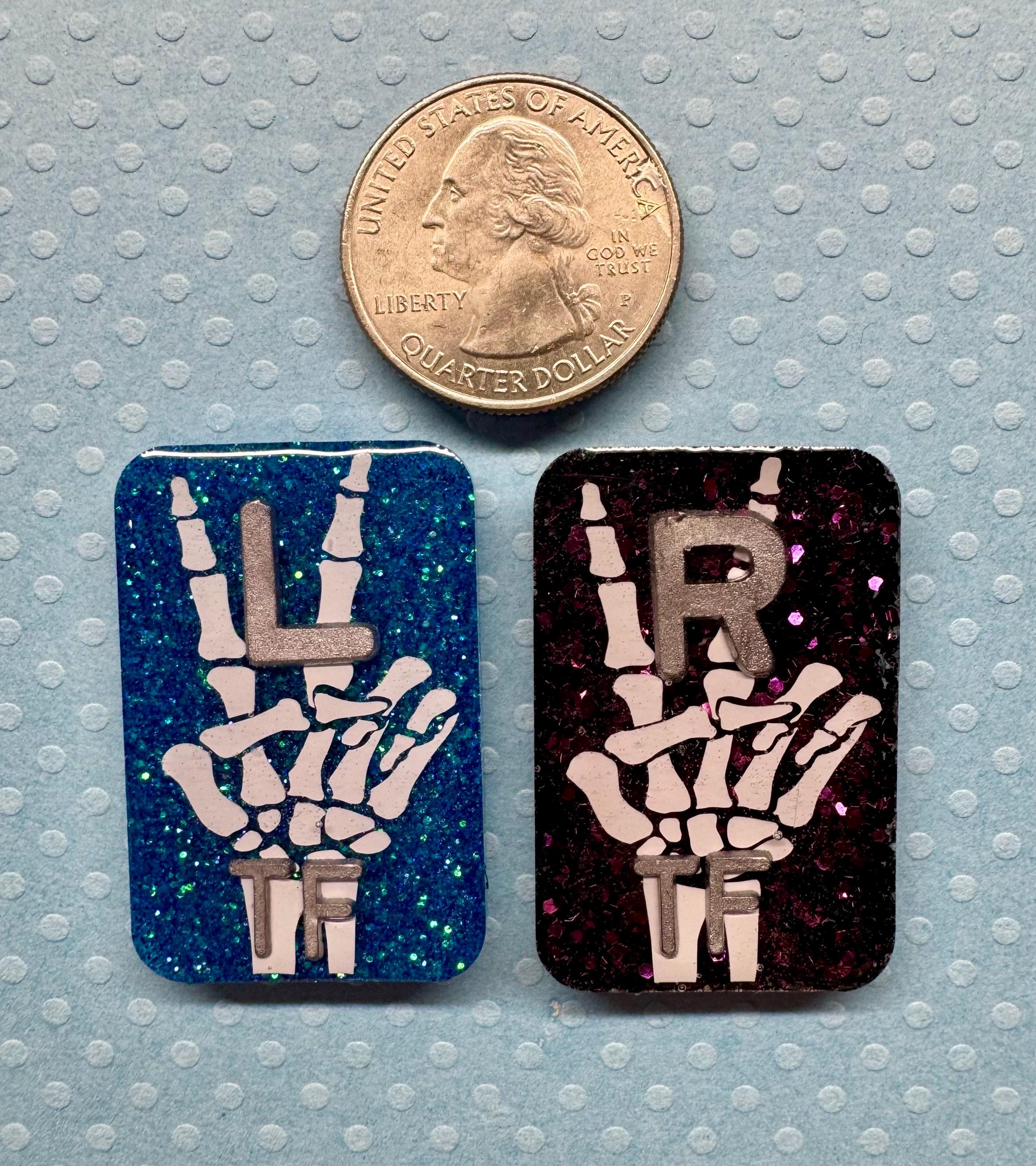 Skeleton Hand X-ray Markers ~ X-ray Markers ~ Radiology Markers ~ Rad ...