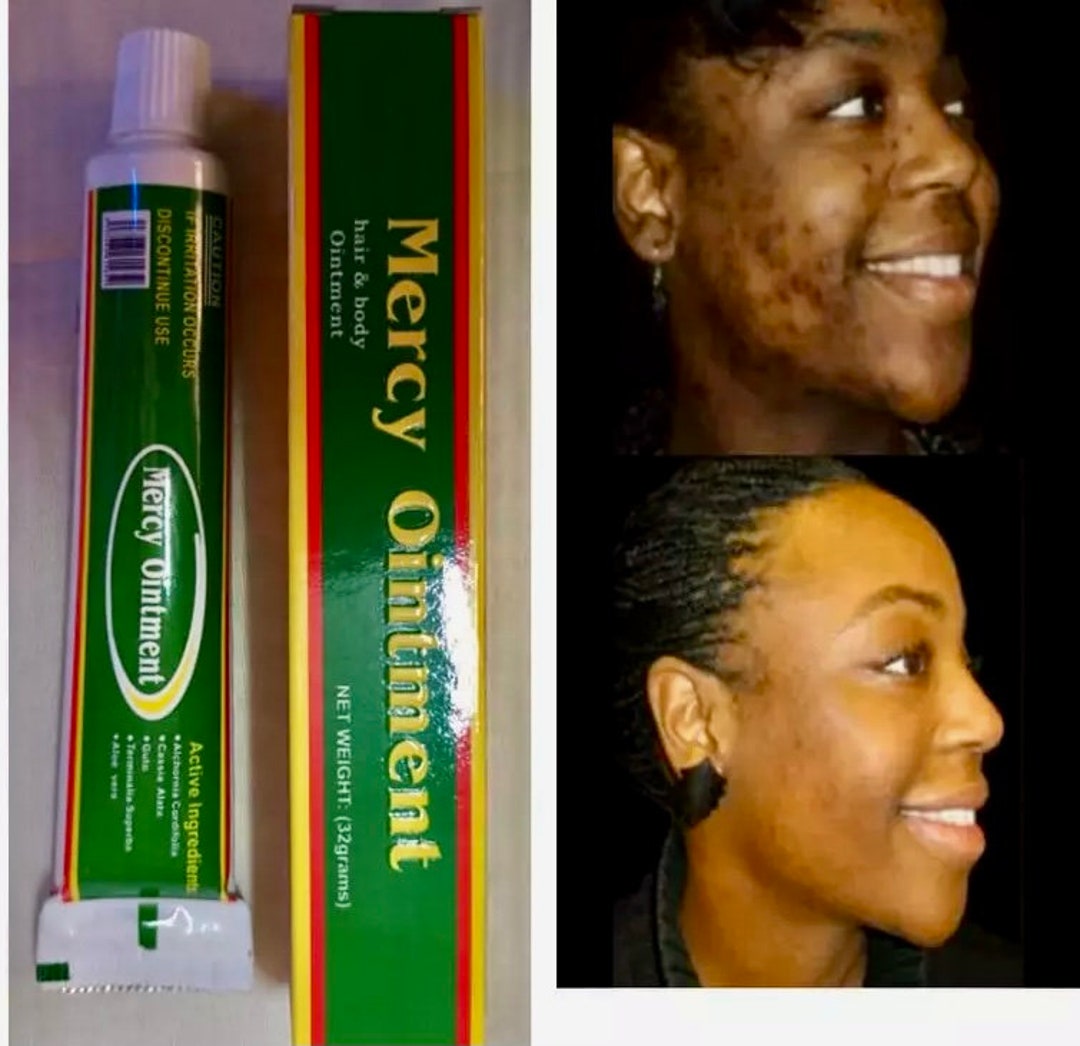 Mercy Cream 32ghair and Body Ointmentpack of Three Cream - Etsy