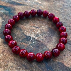 Multiple Myeloma, Sickle Cell Anemia, Meningitis, Cancer| Burgundy ...