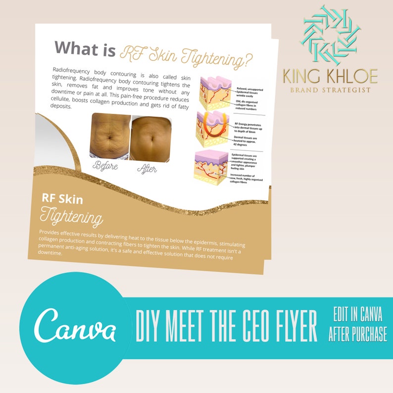 canva-diy-skin-tightening-flyer-diy-esthetician-flyer-diy-etsy