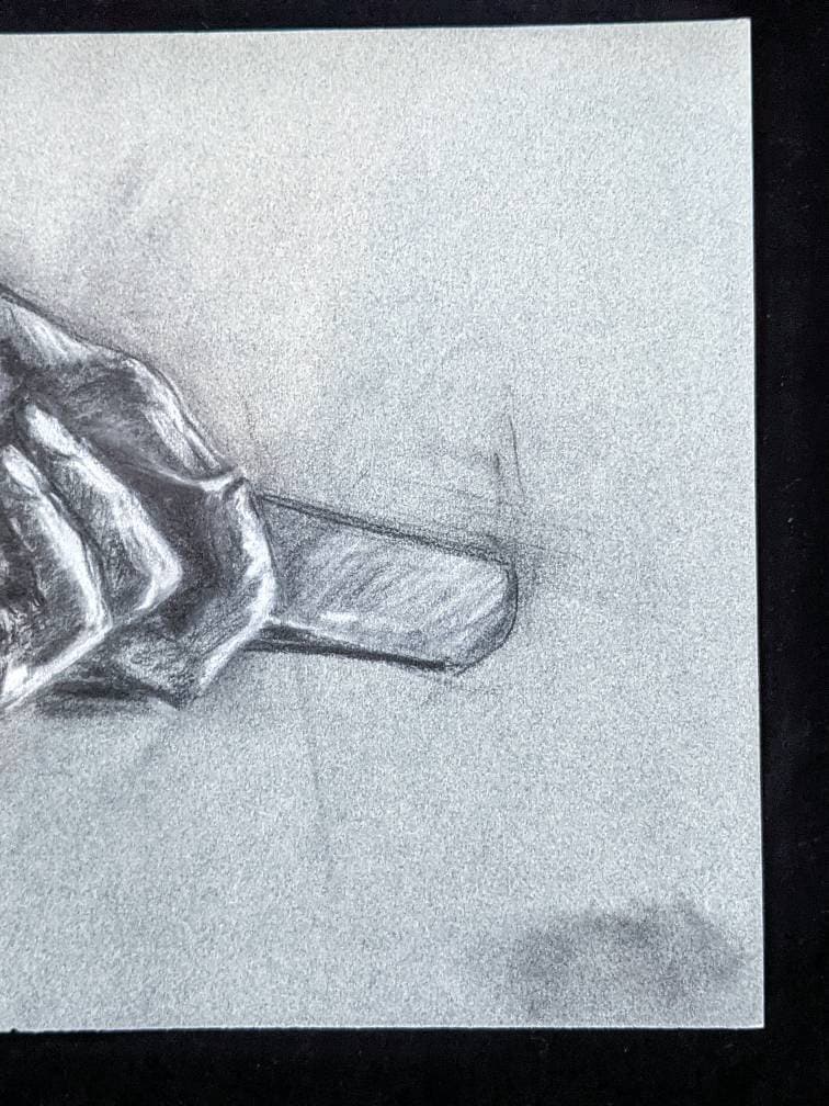 Victorian Anatomical Drawing Hand-drawn Charcoal Sketch Severed Hand ...