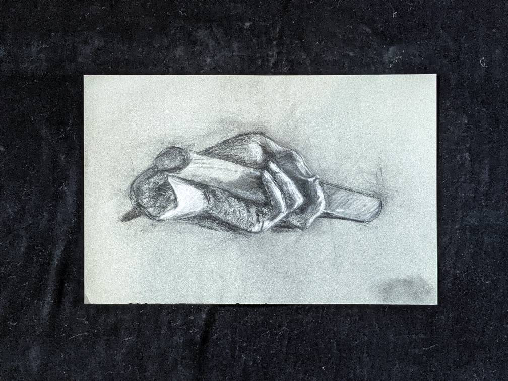 Victorian Anatomical Drawing Hand-drawn Charcoal Sketch Severed Hand ...