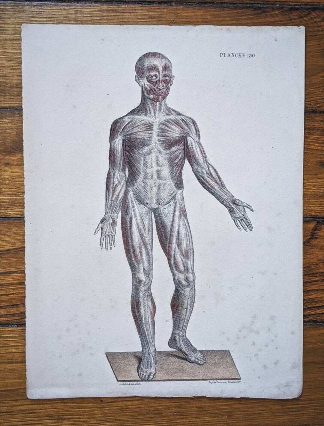 Antique 19th Century French Anatomical Engraving / Skinned Human Body ...