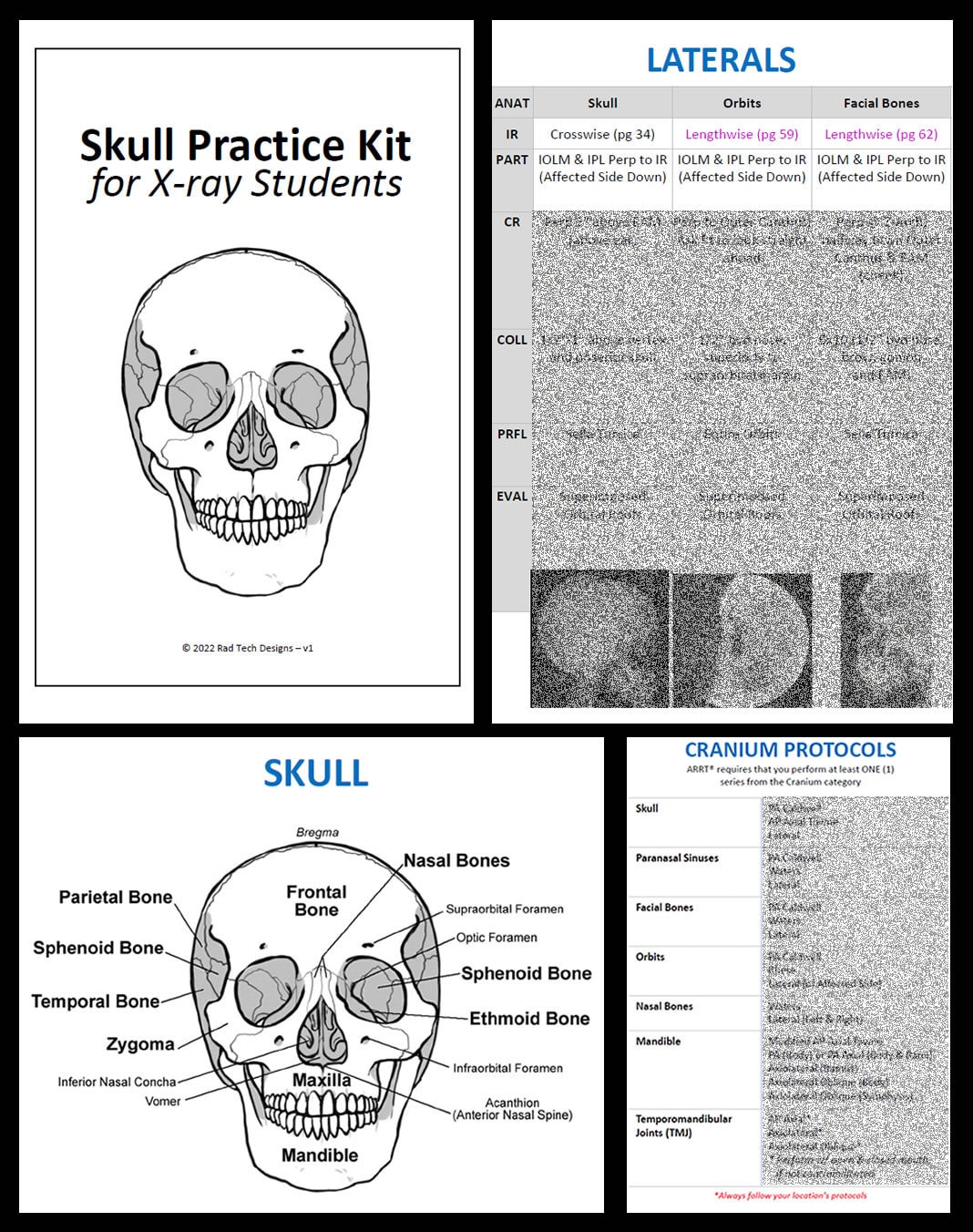 STUDENT Skull Positioning Kit W/ Flashcards GAME! - Etsy