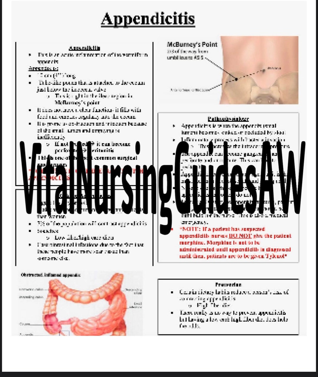 Appendicitis Study Guide - Etsy