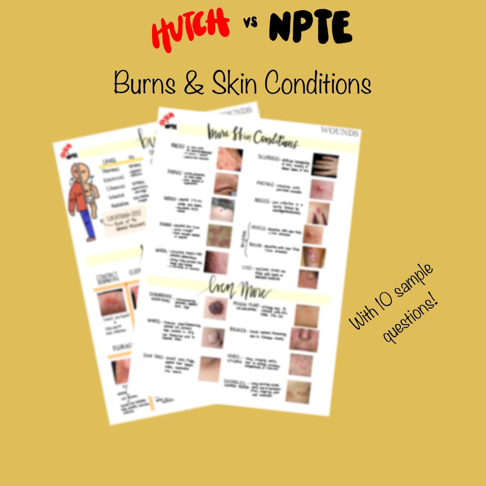 Burns and Skin Conditions - Etsy