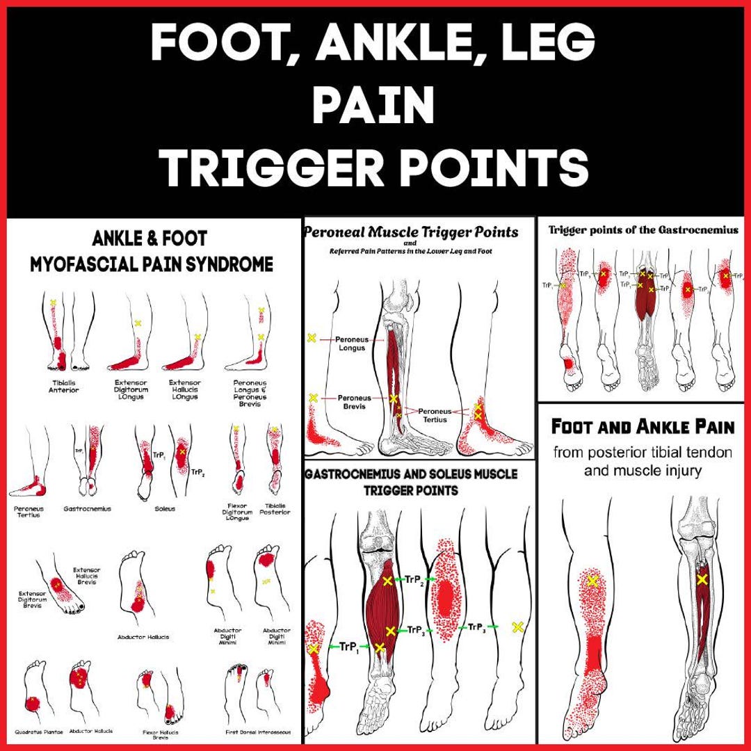 Foot Ankle Leg Pain Trigger Points Chart: Muscle Anatomy Poster ...