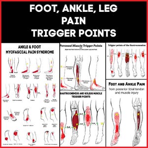 Foot Ankle Leg Pain Trigger Points Chart: Muscle Anatomy Poster ...
