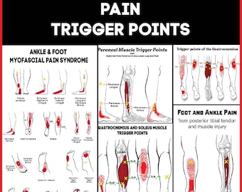 Foot Ankle Leg Pain Trigger Points Chart: Muscle Anatomy Poster ...