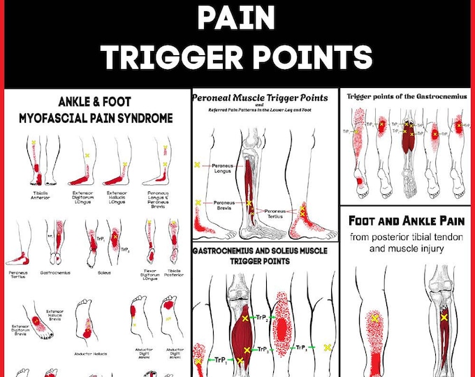 Foot Ankle Leg Pain Trigger Points Chart: Muscle Anatomy Poster ...