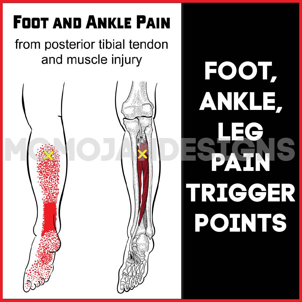 Foot Ankle Leg Pain Trigger Points Chart: Muscle Anatomy Poster ...
