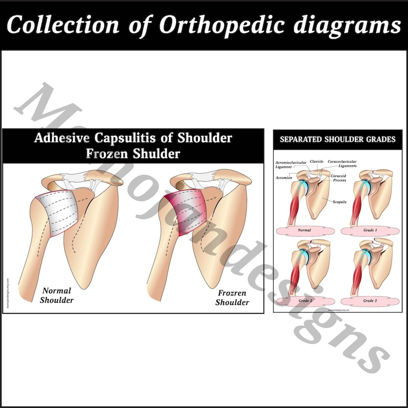 Orthopedic Anatomy Diagrams Poster Set| Medical Educational Charts ...