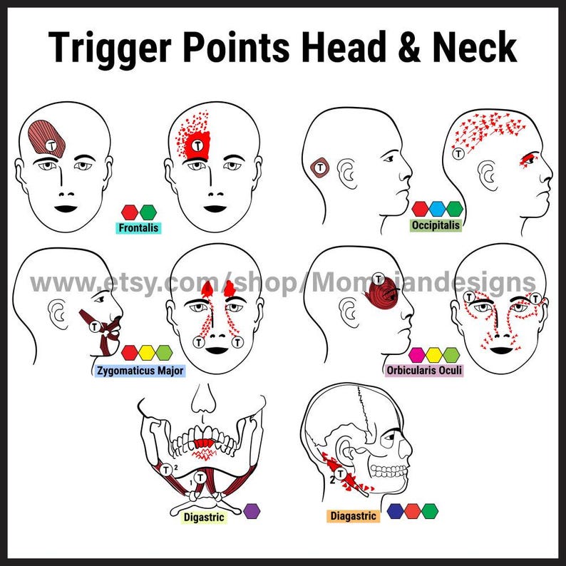 A Collection of Trigger Point Charts Head & Neck Muscle Pain Relief ...