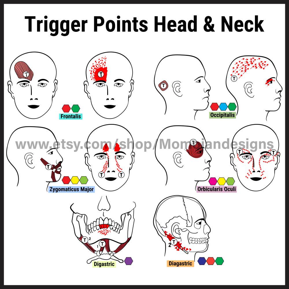 A Collection of Trigger Point Charts Head & Neck Muscle Pain Relief ...