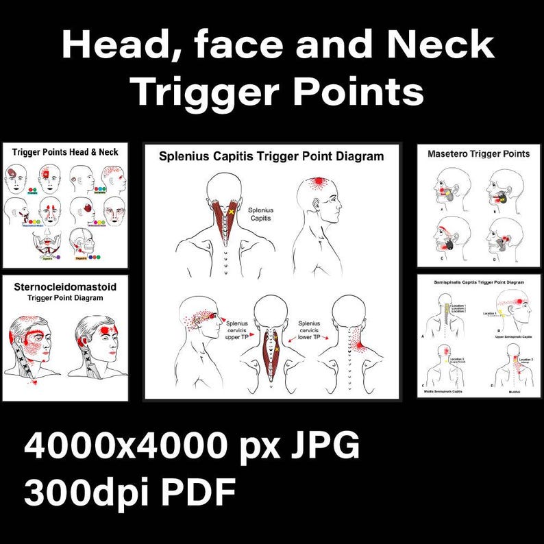 A Collection of Trigger Point Charts Head & Neck Muscle Pain Relief ...