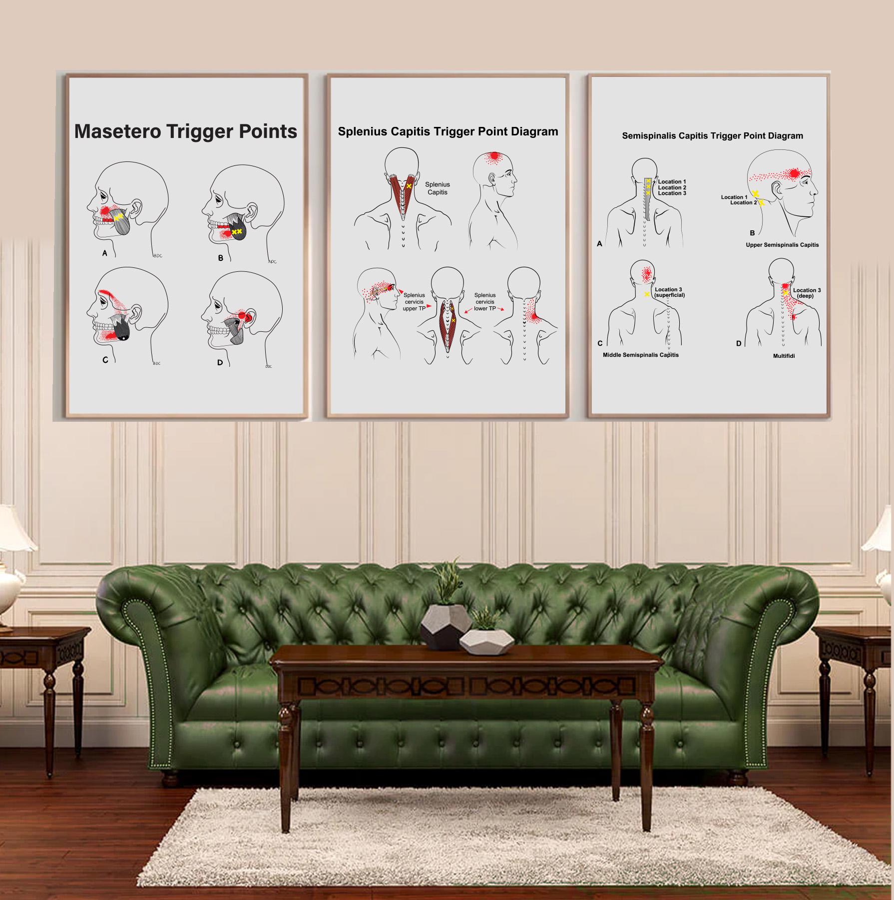 A Collection of Trigger Point Charts Head & Neck Muscle Pain Relief ...