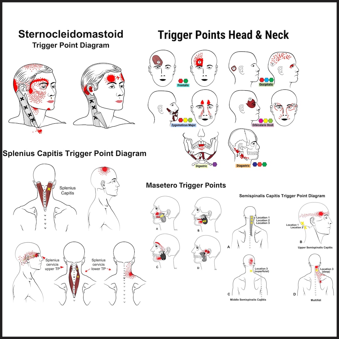 Trigger Point Charts Head & Neck Muscle Pain Relief Chart Reflexology ...