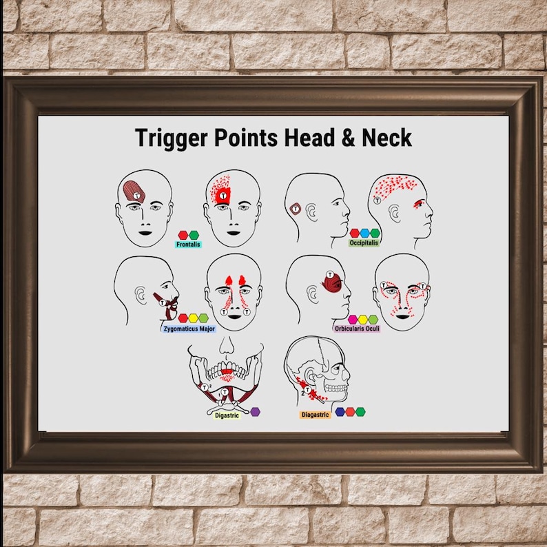 Head & Neck Trigger Point Charts: Muscle Pain Relief Diagrams (PDF) - Etsy