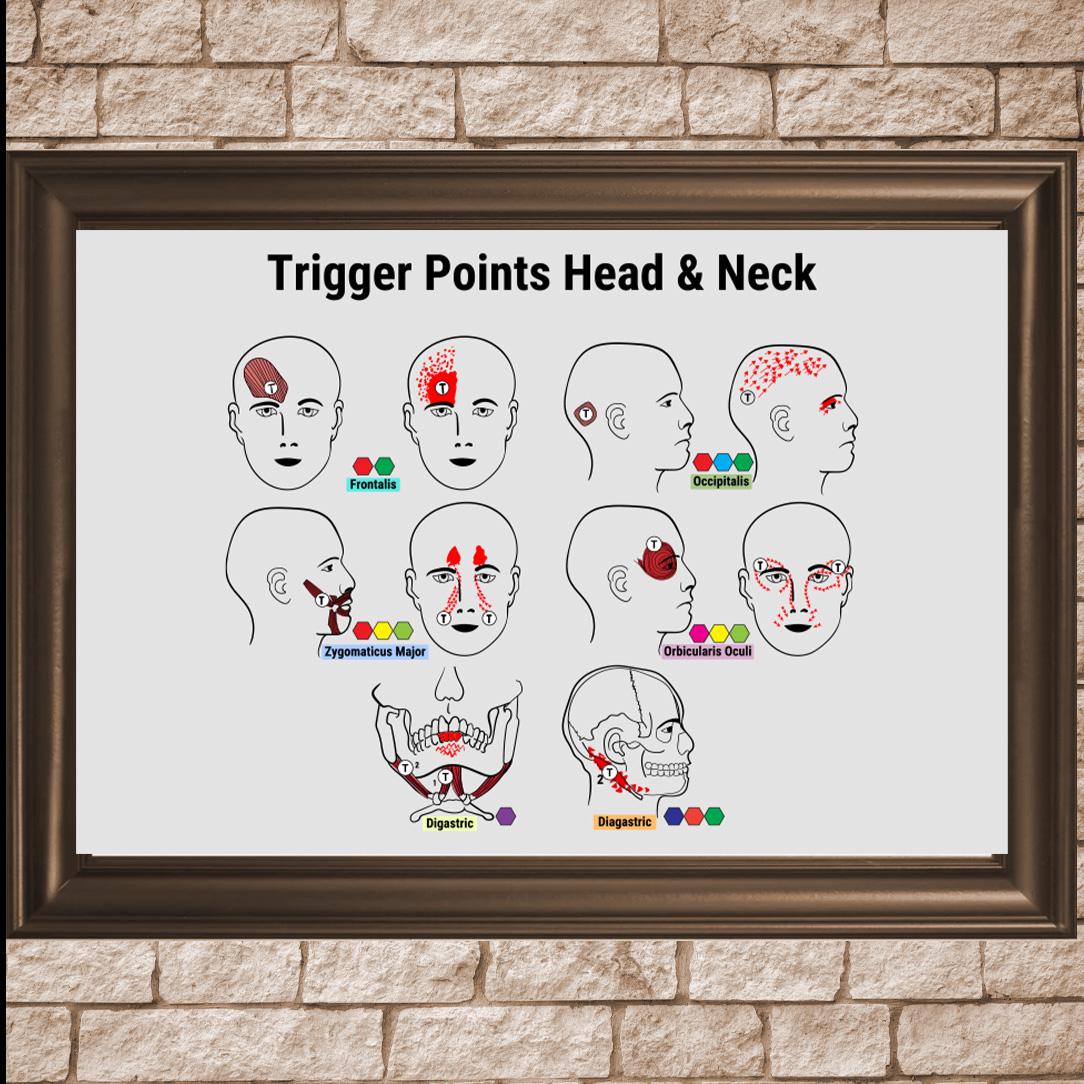 A Collection of Trigger Point Charts Head & Neck Muscle Pain Relief ...
