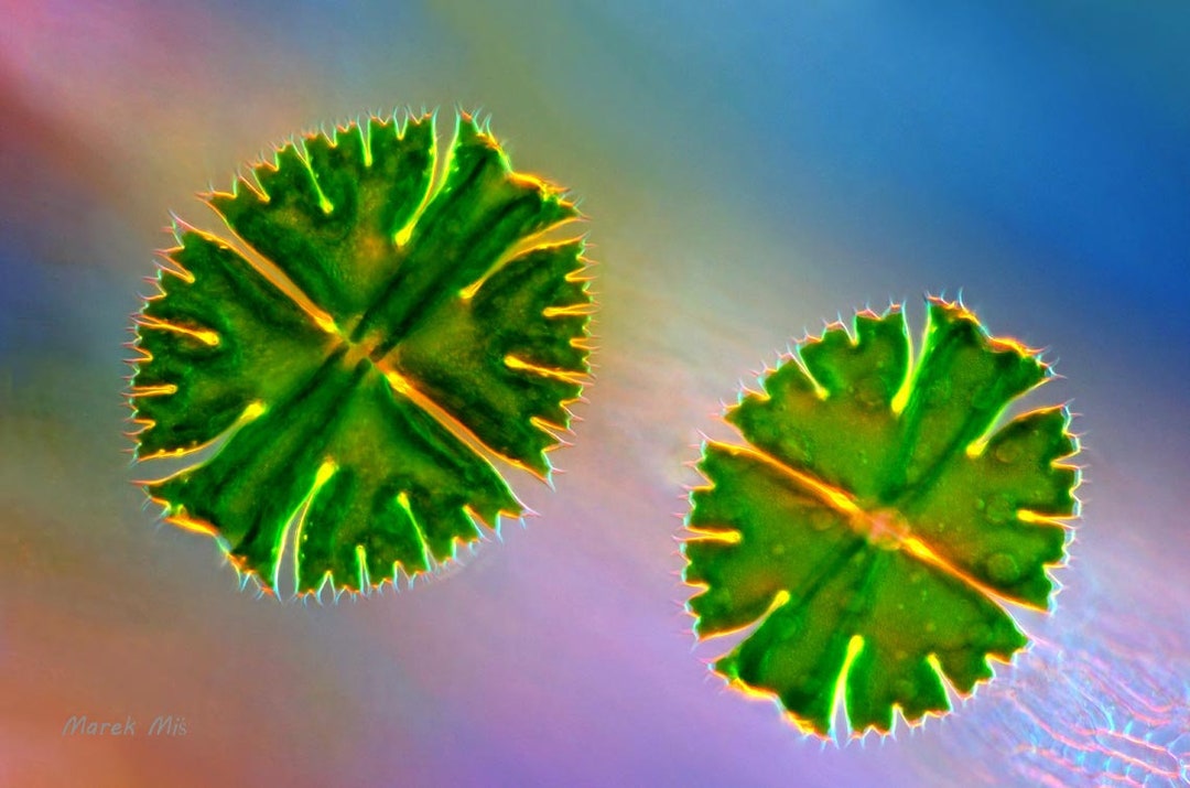 Algae Under the Microscope, Microworld Art, Microworld Art on Wall ...