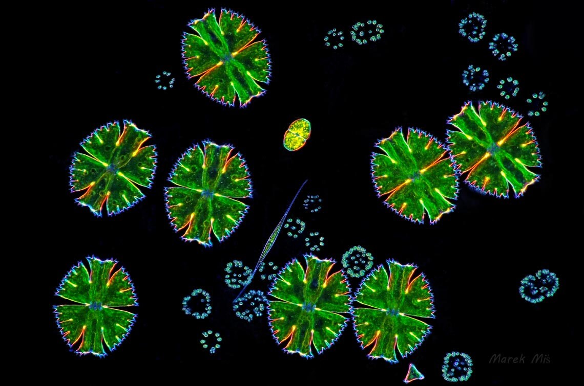 Various Desmids Under the Microscope, Micrasterias, Closterium ...