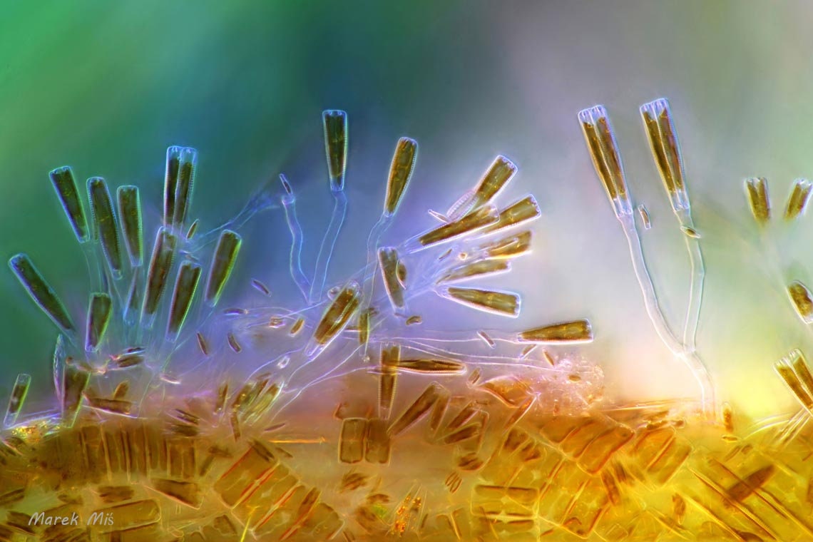 Diatoms Under A Microscope