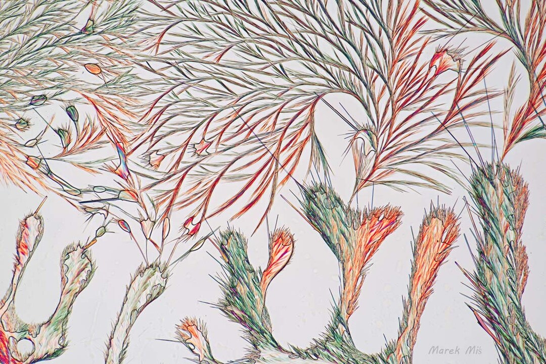 Recrystallized Callus Remover Under the Microscope, Art Under the ...