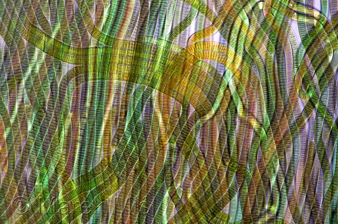 Cyanobacteria Under the Microscope, Art Under the Microscope ...