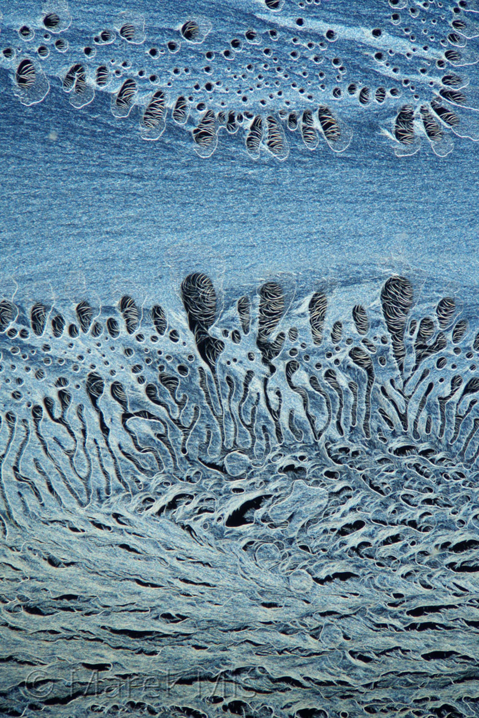 Blue Landscape Artistic Micrograph, Recrystallized Callus Remover Under ...