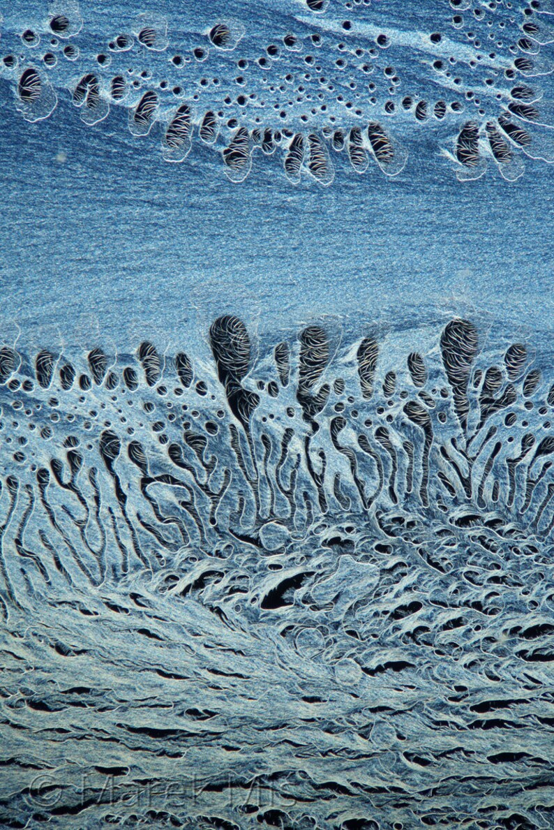 Blue Landscape Artistic Micrograph, Recrystallized Callus Remover Under ...