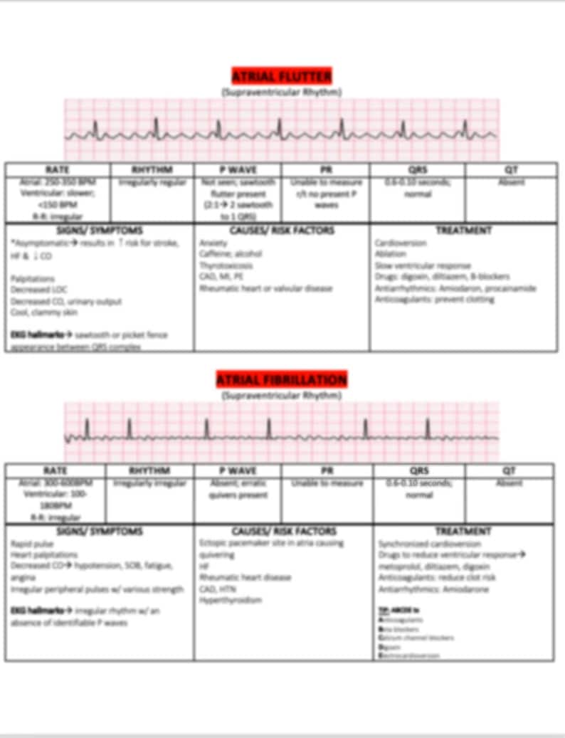 A Flutter & A Fib EKG Interpretation - Etsy