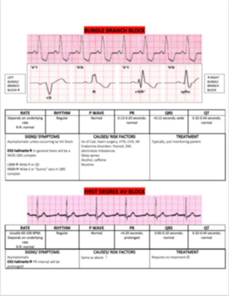 BBB and First Degree AV Block - Etsy