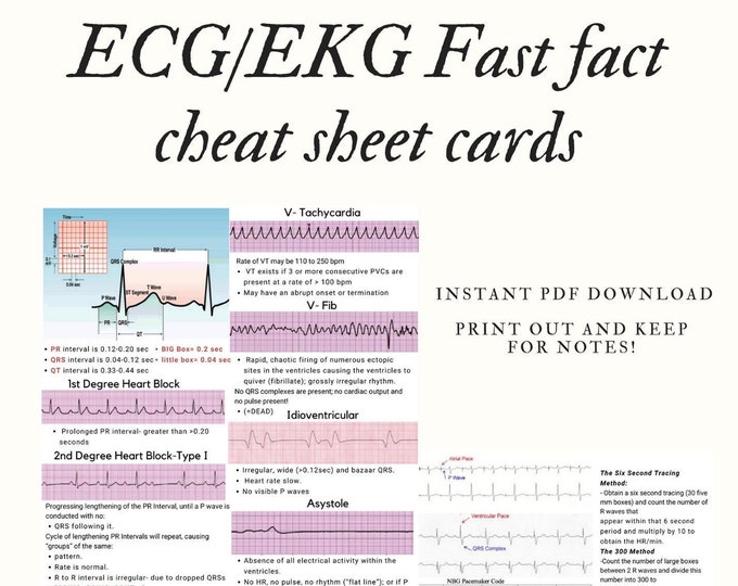 ECG Rhythms Flashcards PDF - Etsy UK
