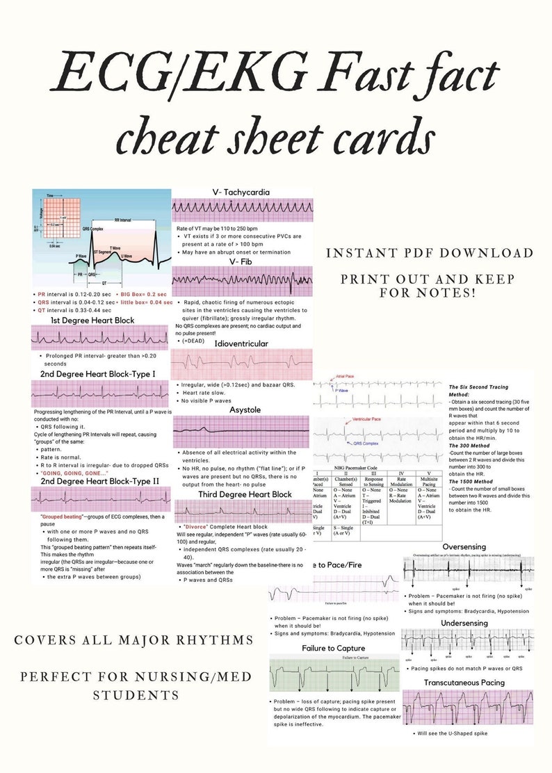 ECG/EKG Fast Fact Cheat Sheet Card - Etsy
