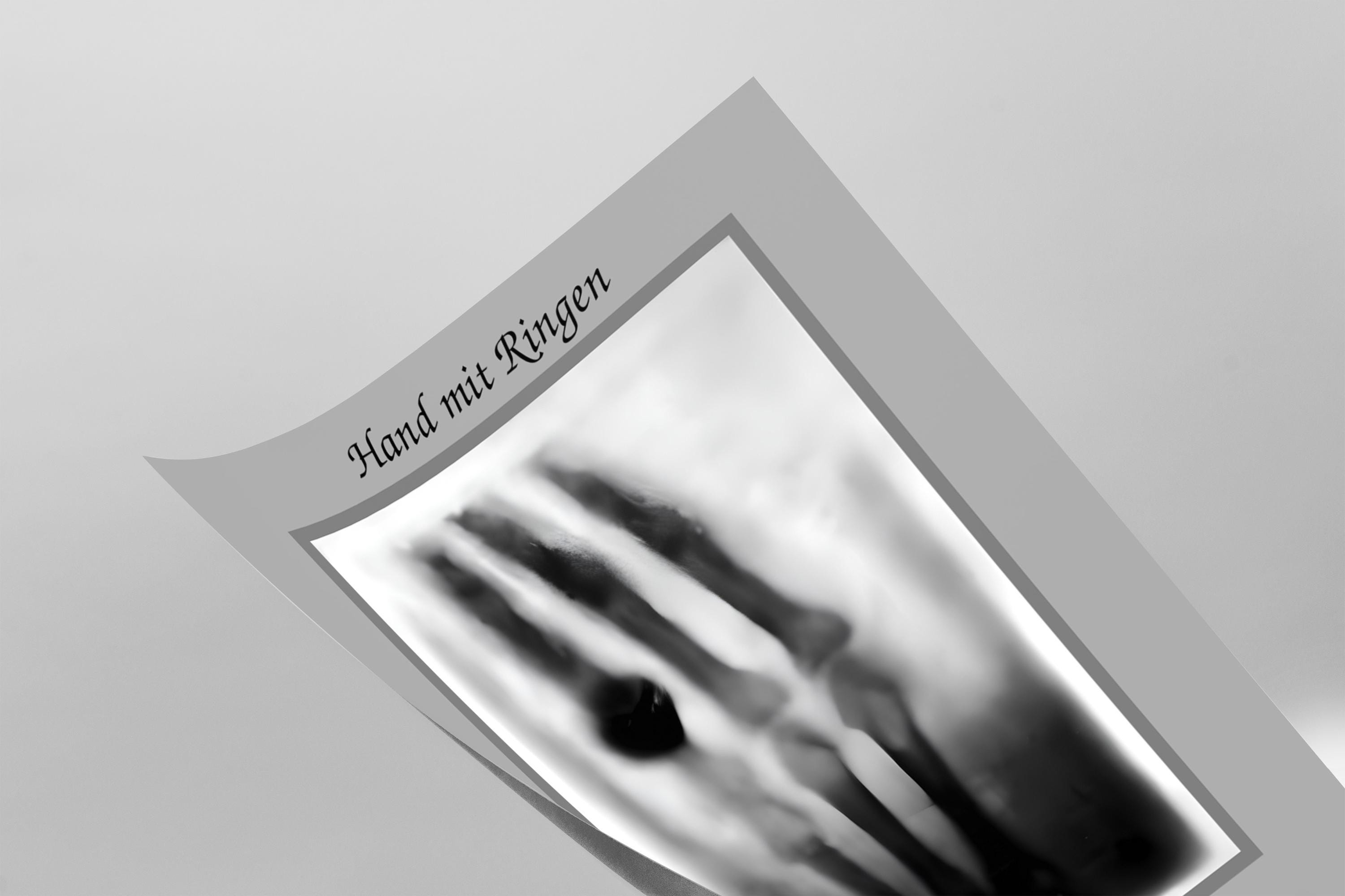 Radiograph of Hand by W.K. Roentgen X-ray Xray Ring Photo Poster Art ...