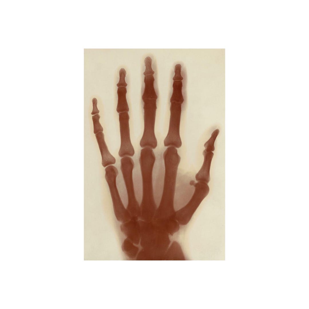 Nikola Tesla’s Left Hand X-ray Xray Radiograph Photo Poster Art Print ...