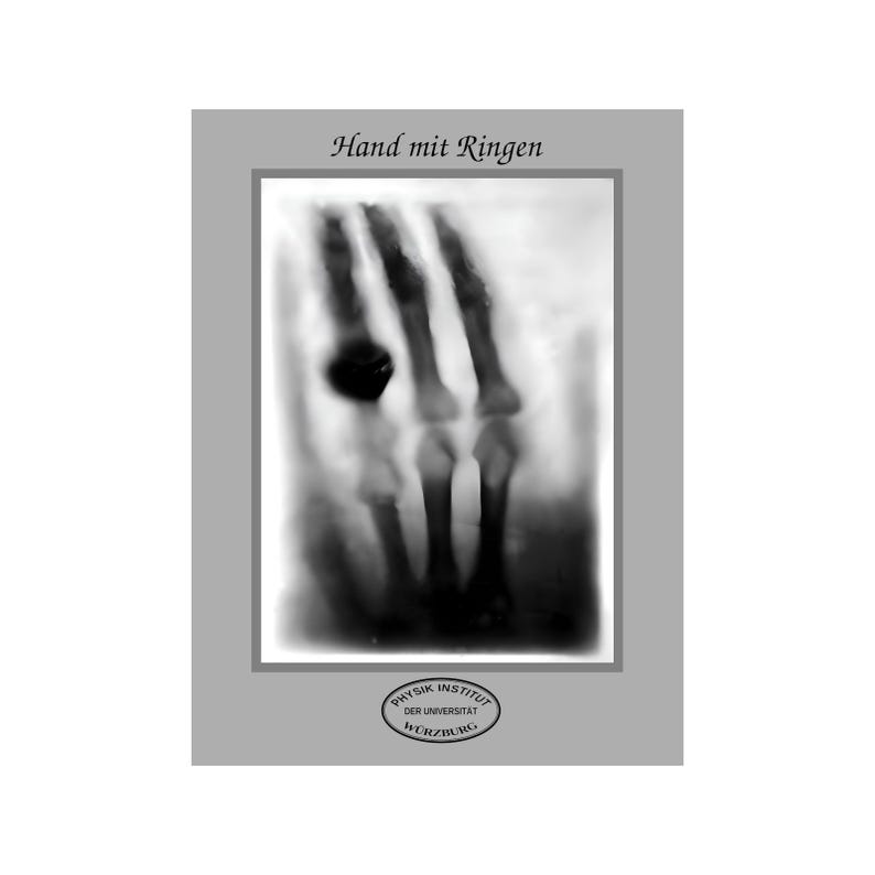 Radiograph of Hand by W.K. Roentgen X-ray Xray Ring Photo Poster Art ...