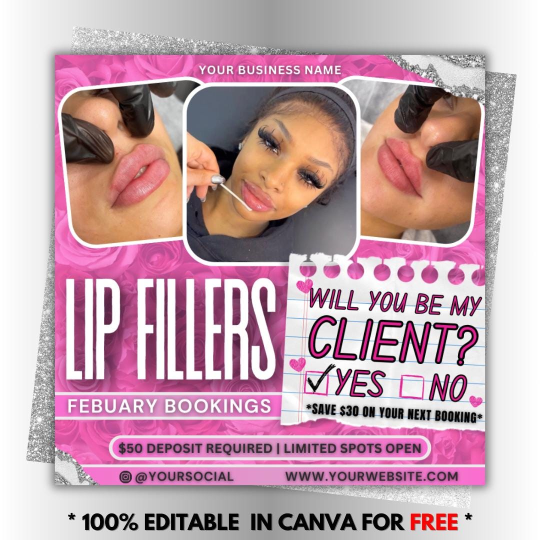 Hyaluron Pen Flyer, Lip Filler Booking Flyer, February Esthetician ...