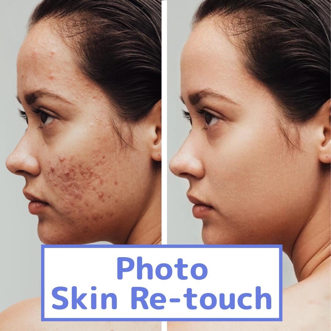 Skin Photo Retouch, Photoshop Skin Retouch, Remove Spots and Pimple ...