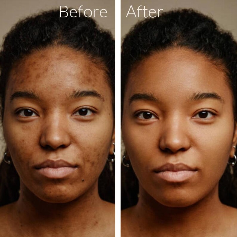Skin Photo Retouch, Photoshop Skin Retouch, Remove Spots and Pimple ...