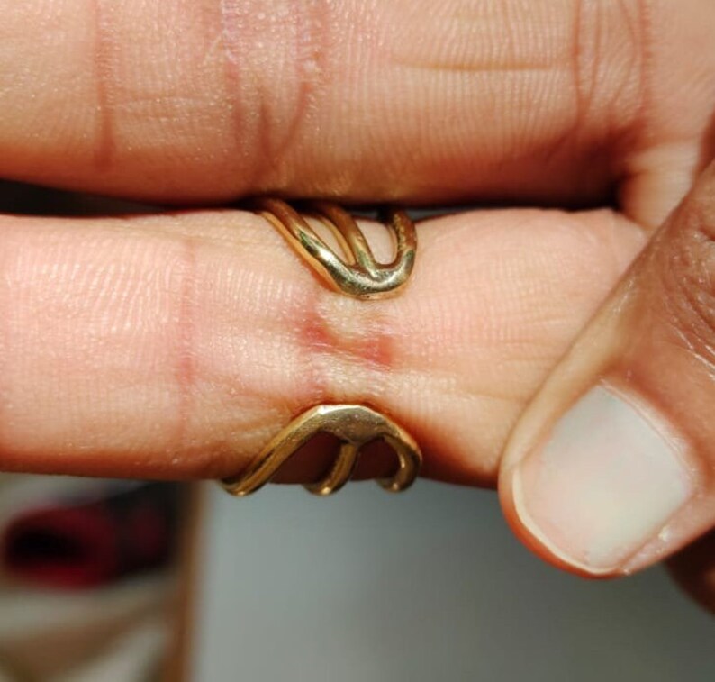 Arthritis Ring Thumb Ring Splint Knuckle Ring Brass Ring - Etsy