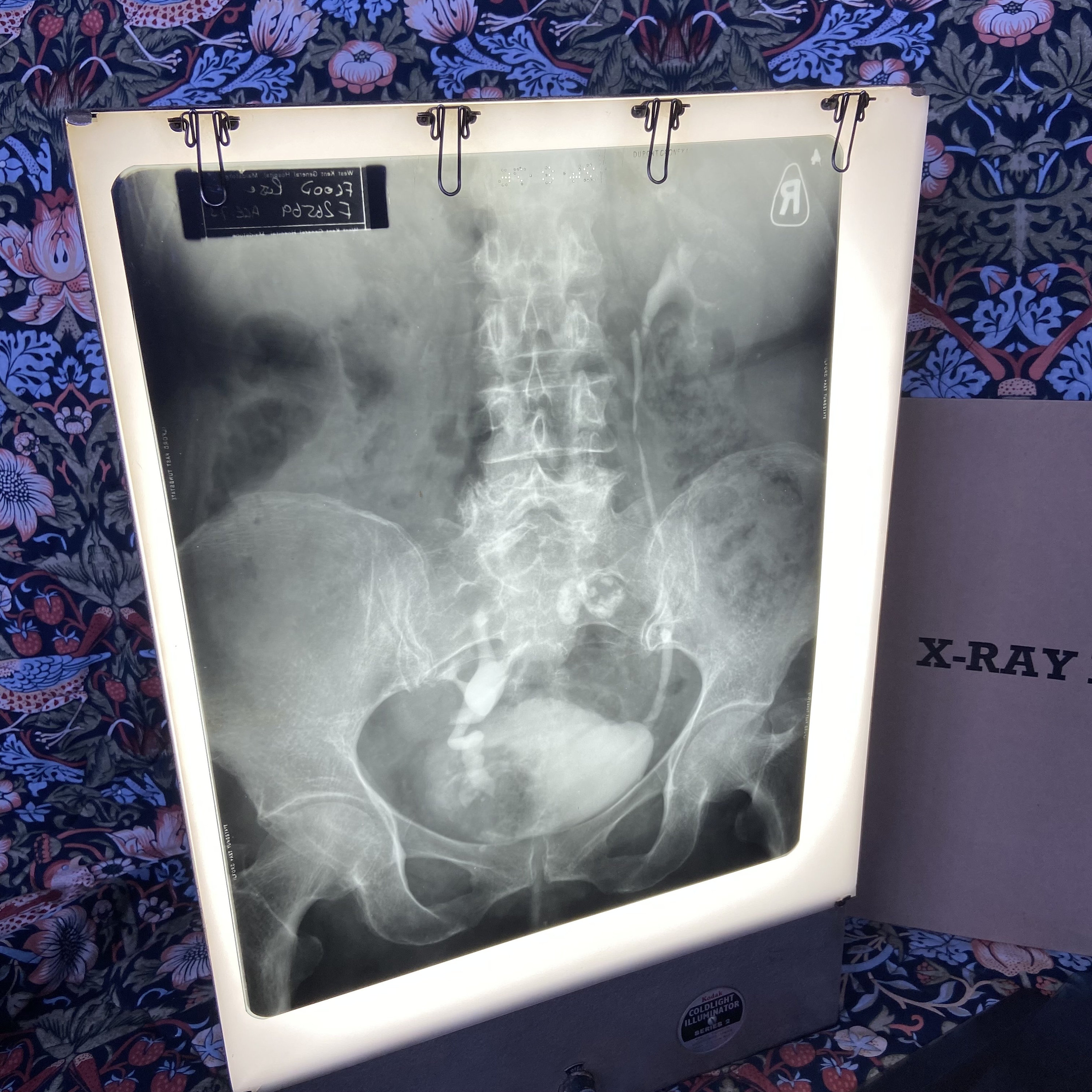 10x X-rays RARE ORIGINAL Hospital Medical X-rays Real Scientific ...