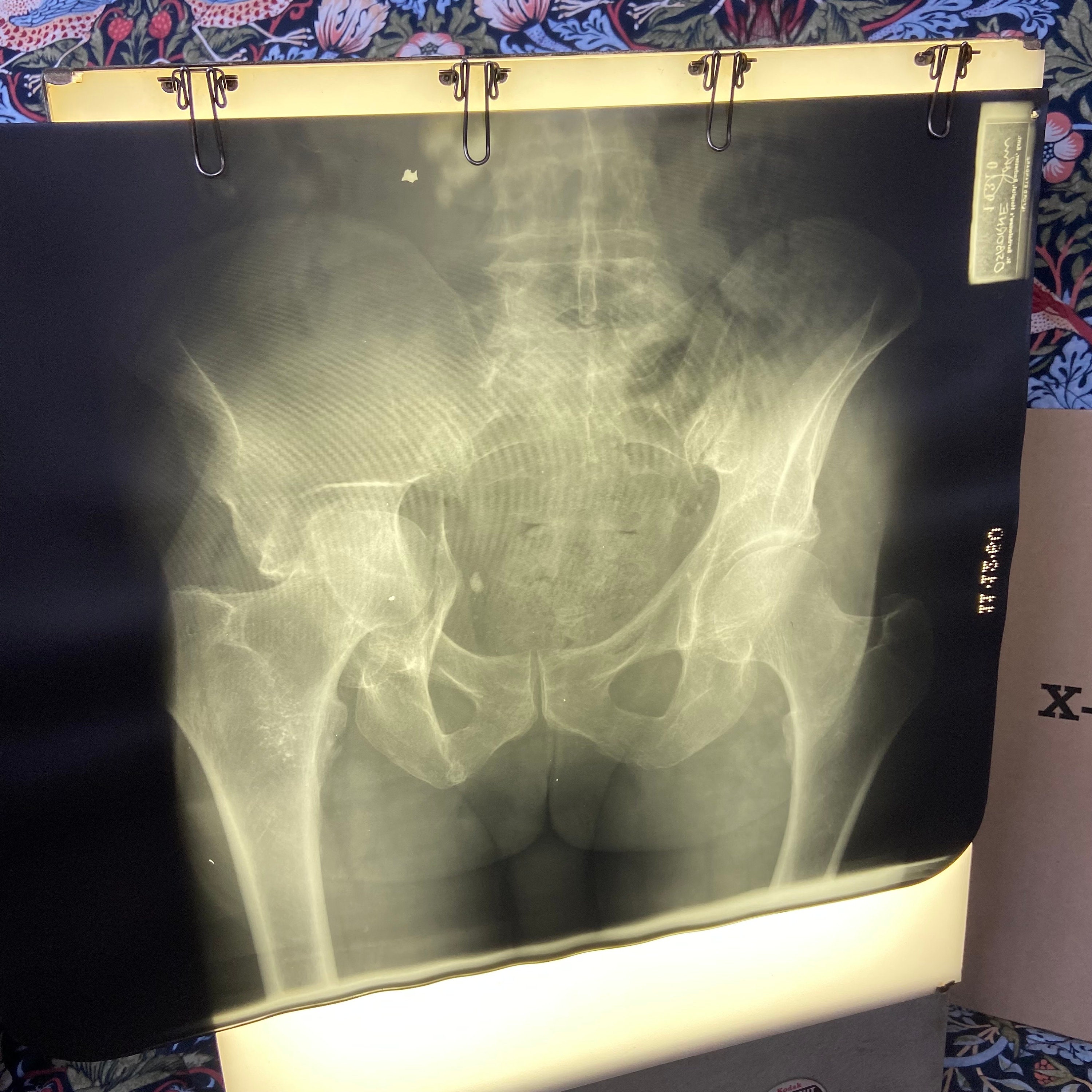 10x X-rays RARE ORIGINAL Hospital Medical X-rays Real Scientific ...