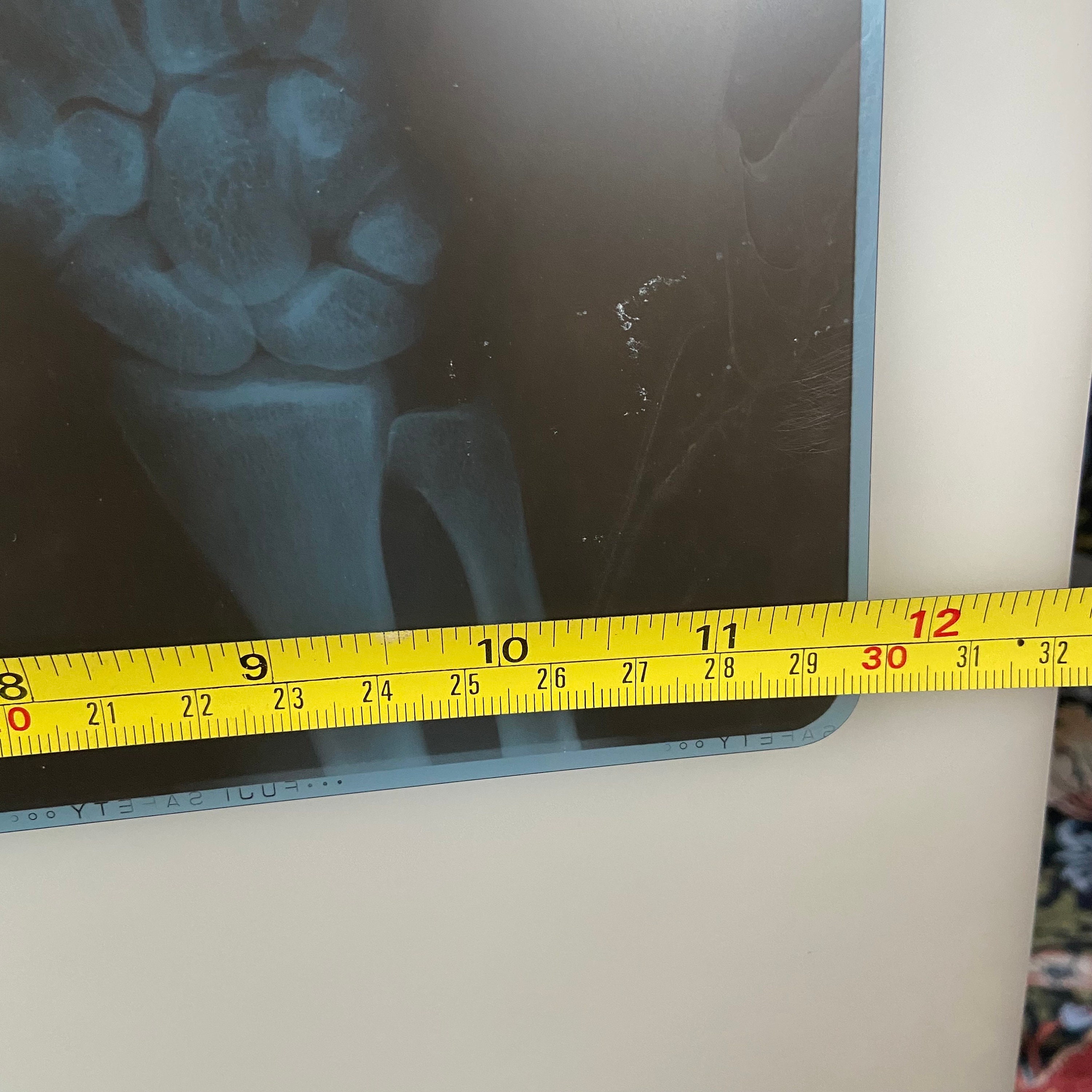 SELTENE Original Vintage X-RAY Hand Skelett Menschliche Hände Echt ...