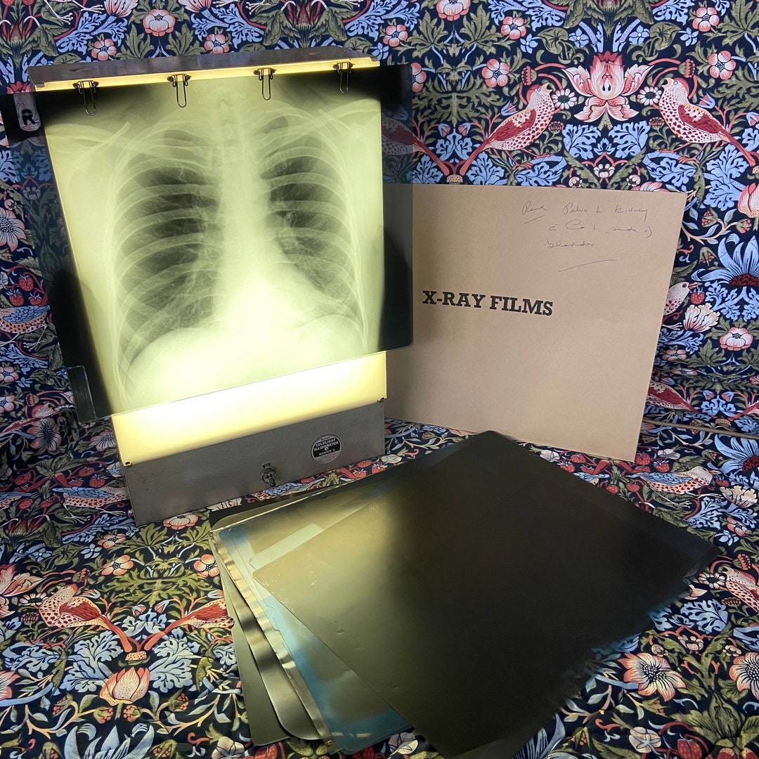 10x X-rays RARE ORIGINAL Hospital Medical X-rays Real Scientific ...