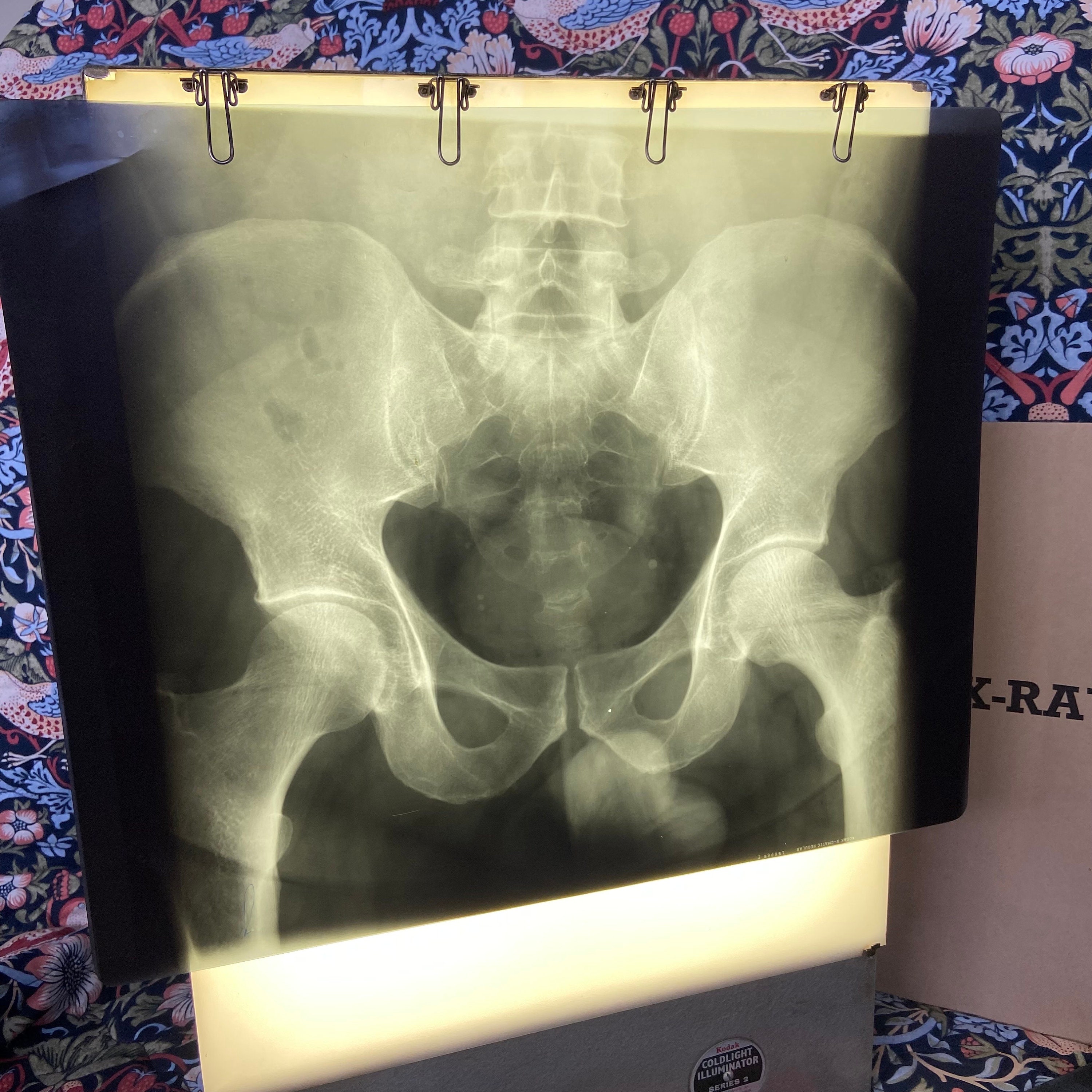 10x X-rays RARE ORIGINAL Hospital Medical X-rays Real Scientific ...