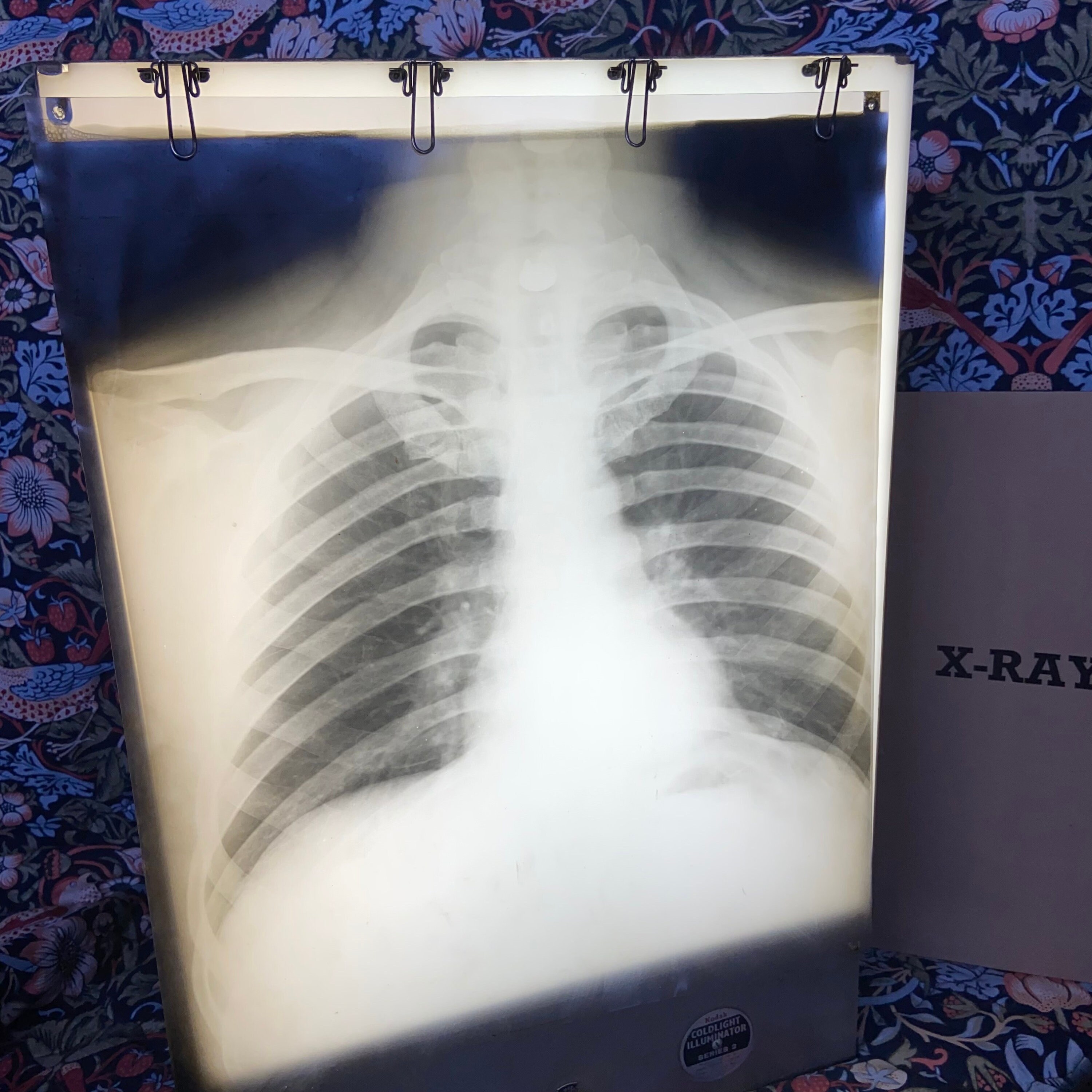 10x X-rays RARE ORIGINAL Hospital Medical X-rays Real Scientific ...